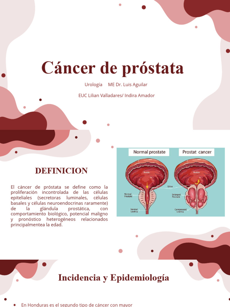 Uro Cap | PDF | Cancer de prostata | Antígeno específico de la próstata