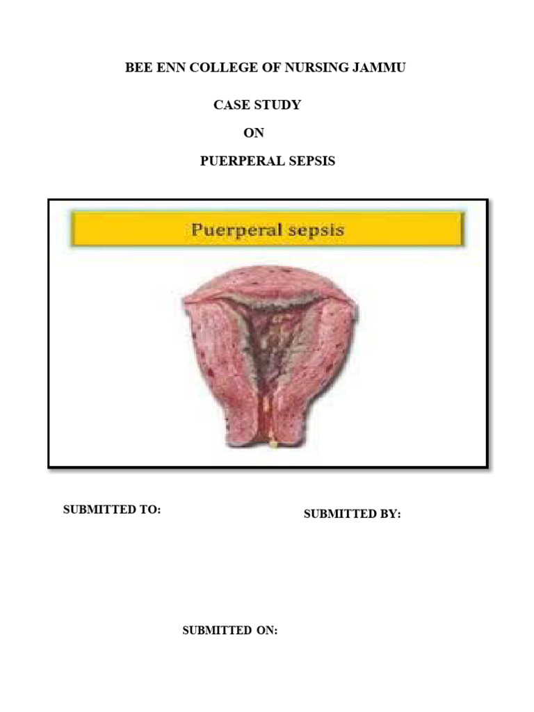 Puerperal Sepsis CASE STUDY - 091241 | PDF | Sepsis | Urinary Tract ...