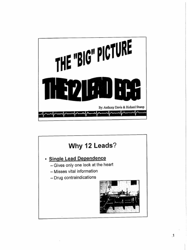 12 Lead Class Handout | PDF