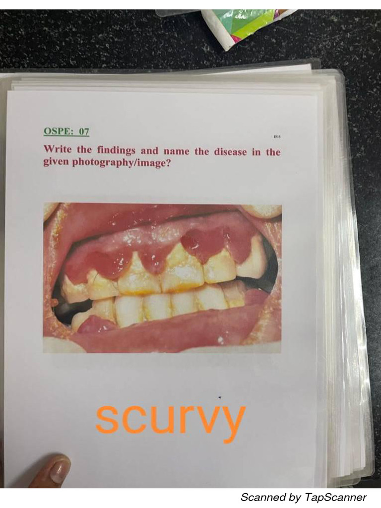 Biochem Ospe and Clinical | PDF