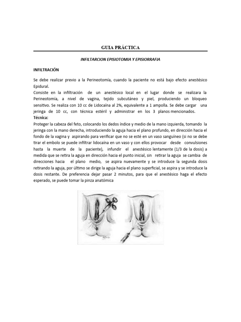 Guía de Episiotomía y Episiorrafia | PDF | Vagina | Parto