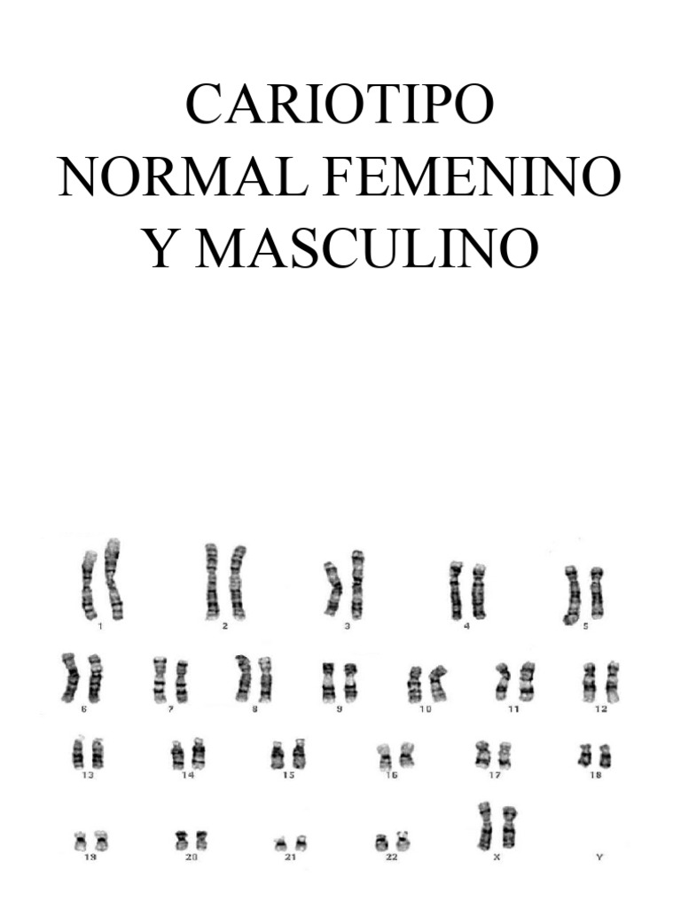 Cariotipo Normal Femenino y Masculino | PDF | Enfermedades y trastornos ...