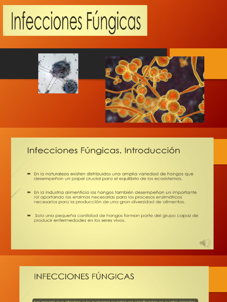 14infecciones Fungicas. | PDF