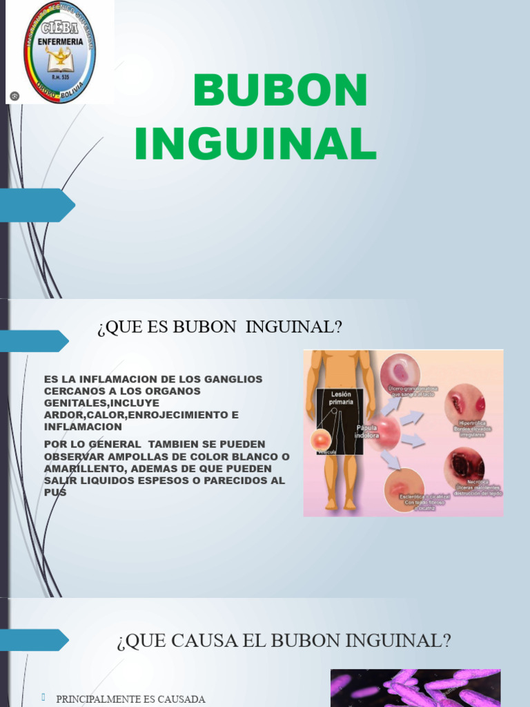Bubon Inguinal | PDF