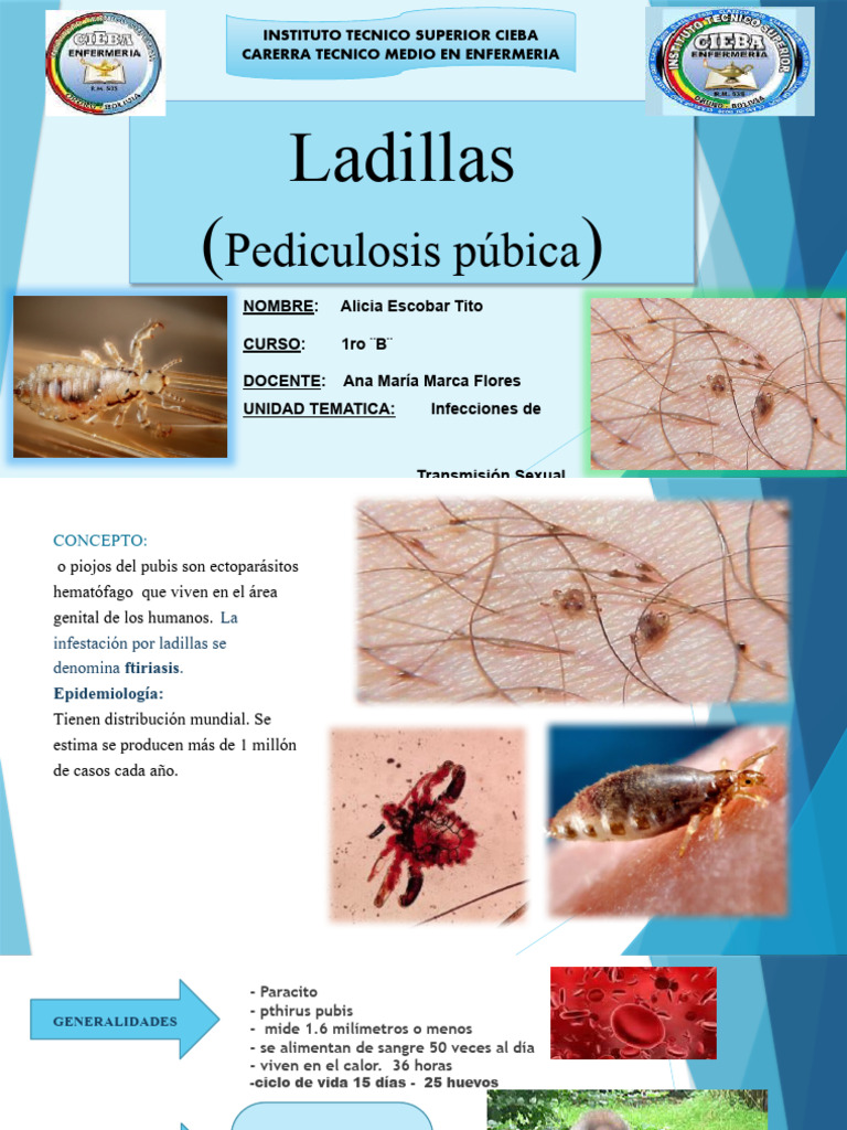 LADILLAS Exponer..... | PDF