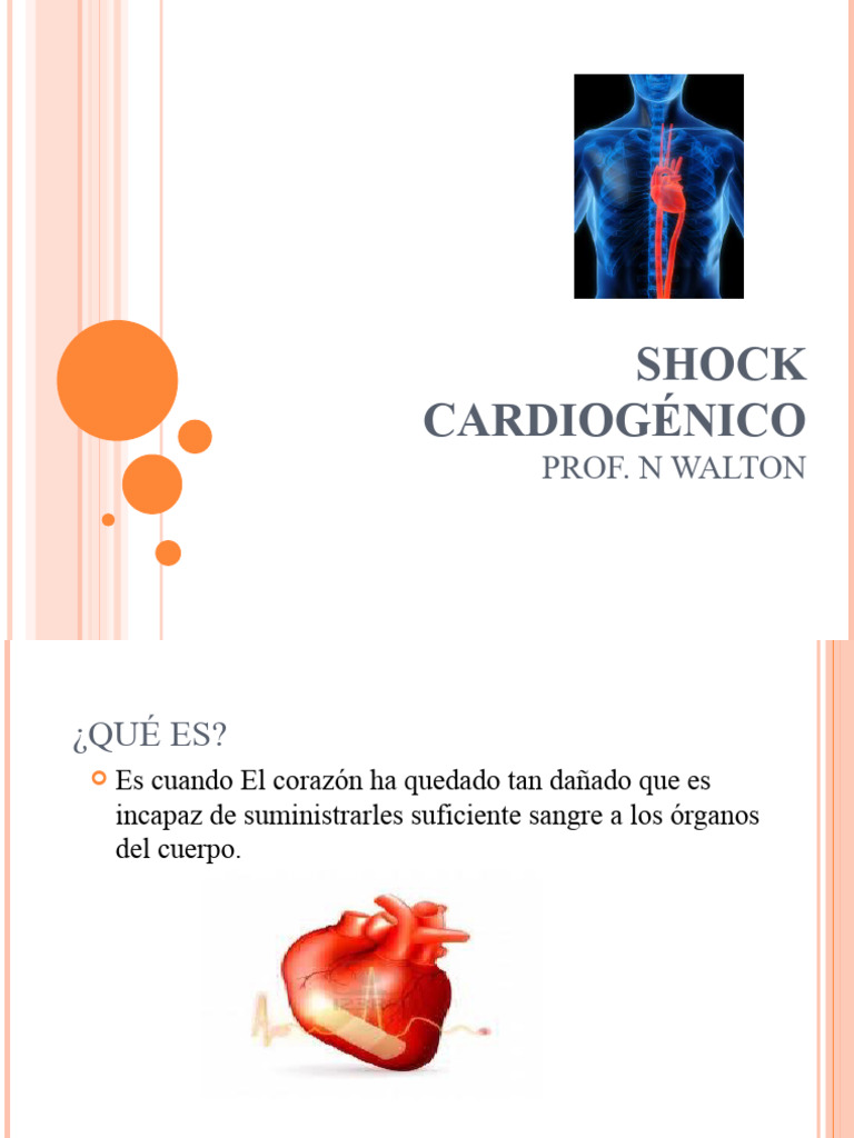 Causas y Tratamiento del Shock Cardiogénico | PDF | Corazón | Cardiología