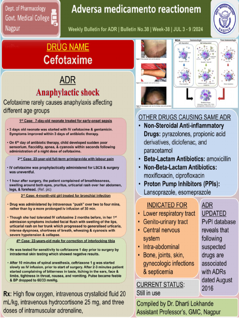 Anaphylactic Shock | PDF