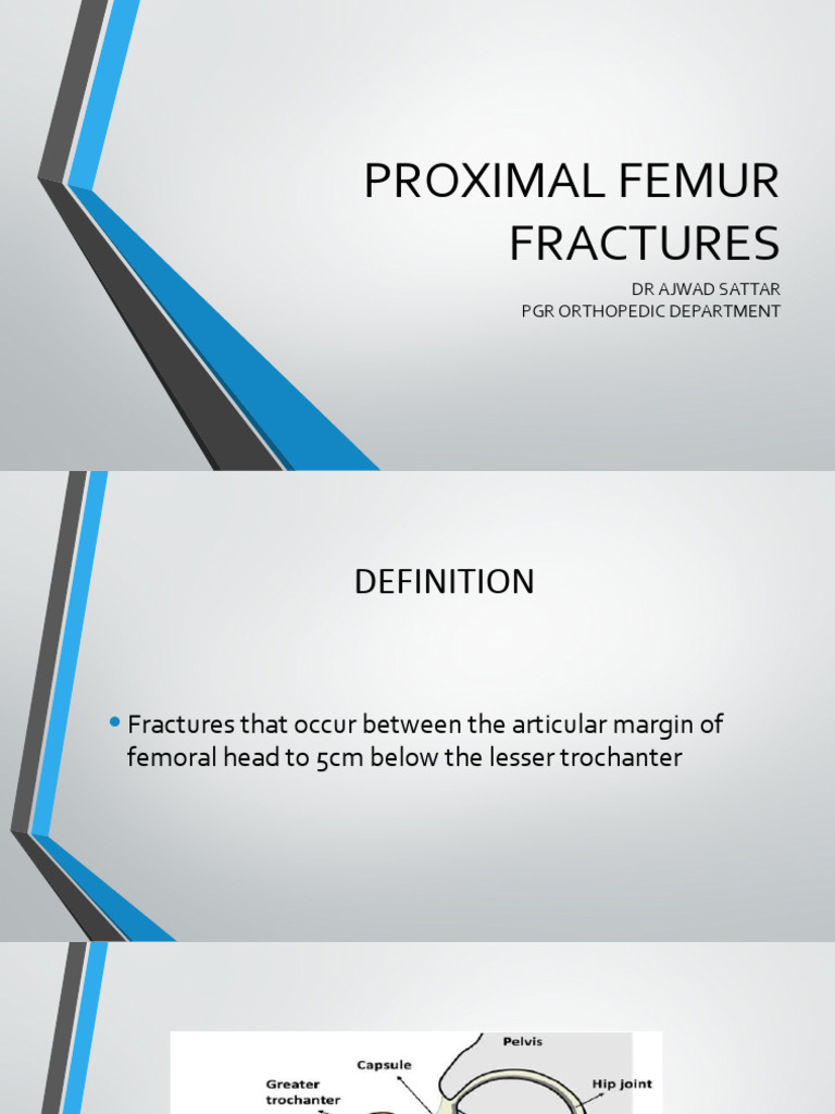 Proximal Femur Fractures Guide | PDF