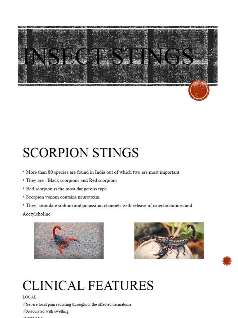 Insect Stings | PDF