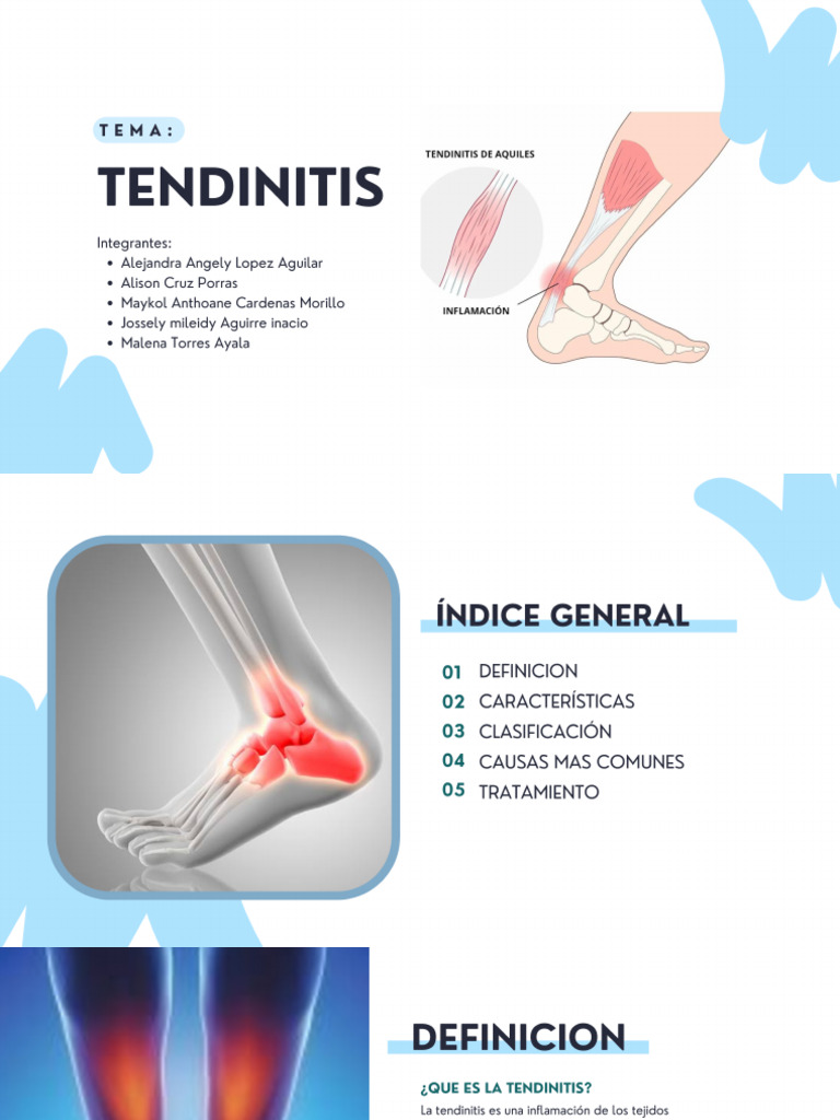 Tendinitis | PDF