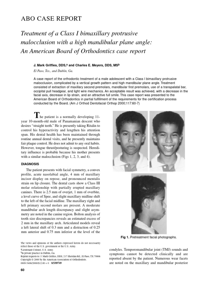 Treatment of A Class I Bimaxillary Protrusive Malocclusion With A High ...