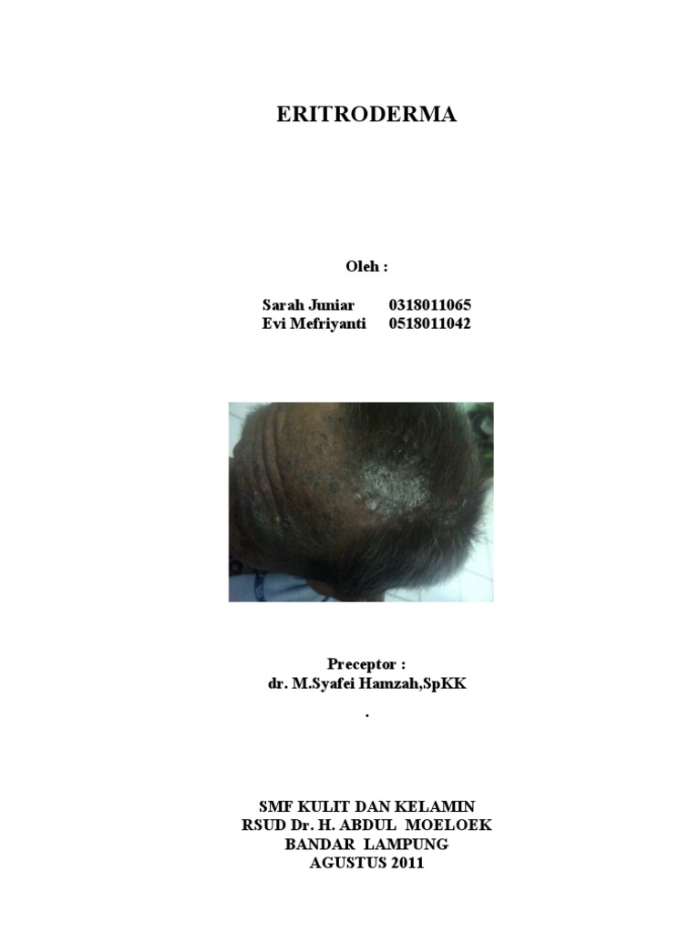 ERITRODERMA: OVERVIEW AND PATHOPHYSIOLOGY | PDF