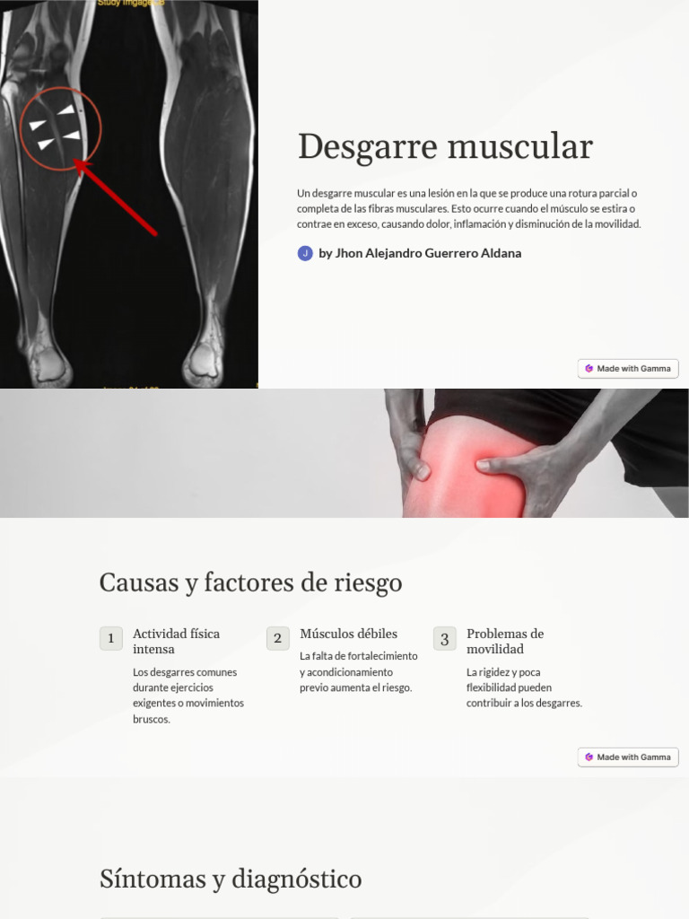 Desgarre muscular: causas, síntomas y tratamiento | PDF