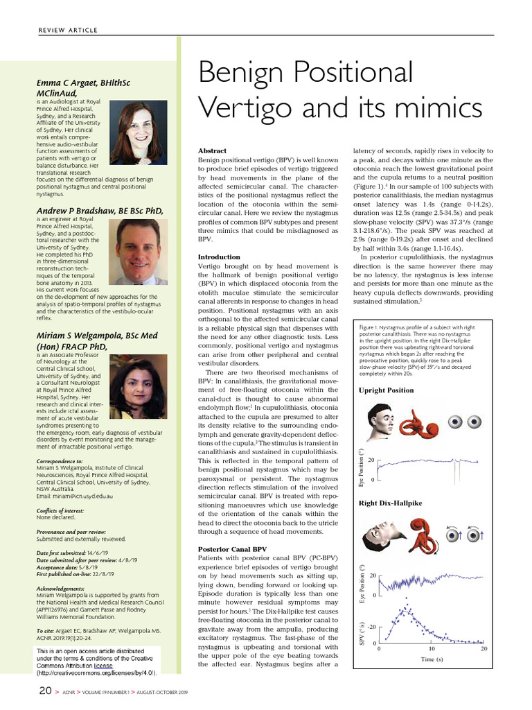 Benign Positional Vertigo and Its Mimics | PDF | Vertigo | Clinical Medicine