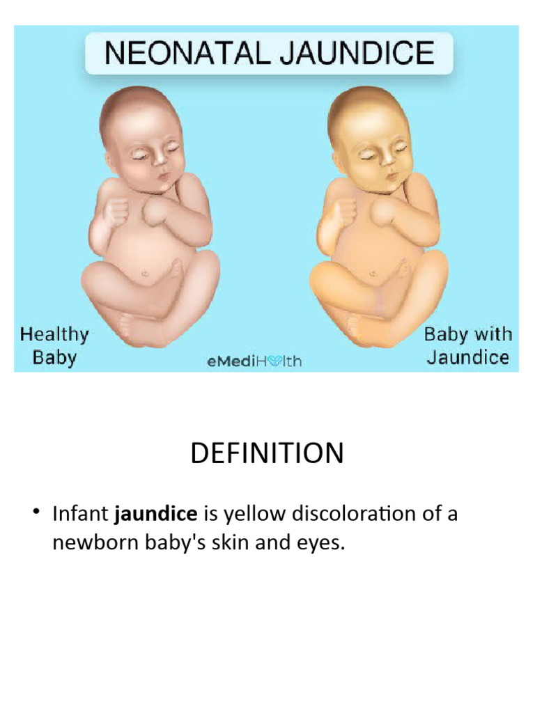 Jaundice | PDF | Diseases And Disorders | Clinical Medicine