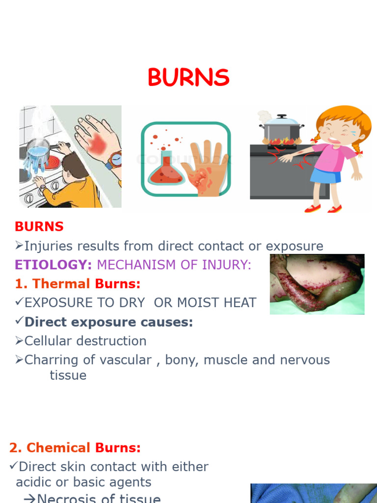 BURNS | PDF | Burn | Wound