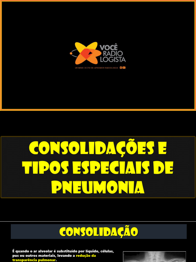 Módulo 03 - Slides - PARENQUIMA | PDF | Neoplasmas | Pneumonia