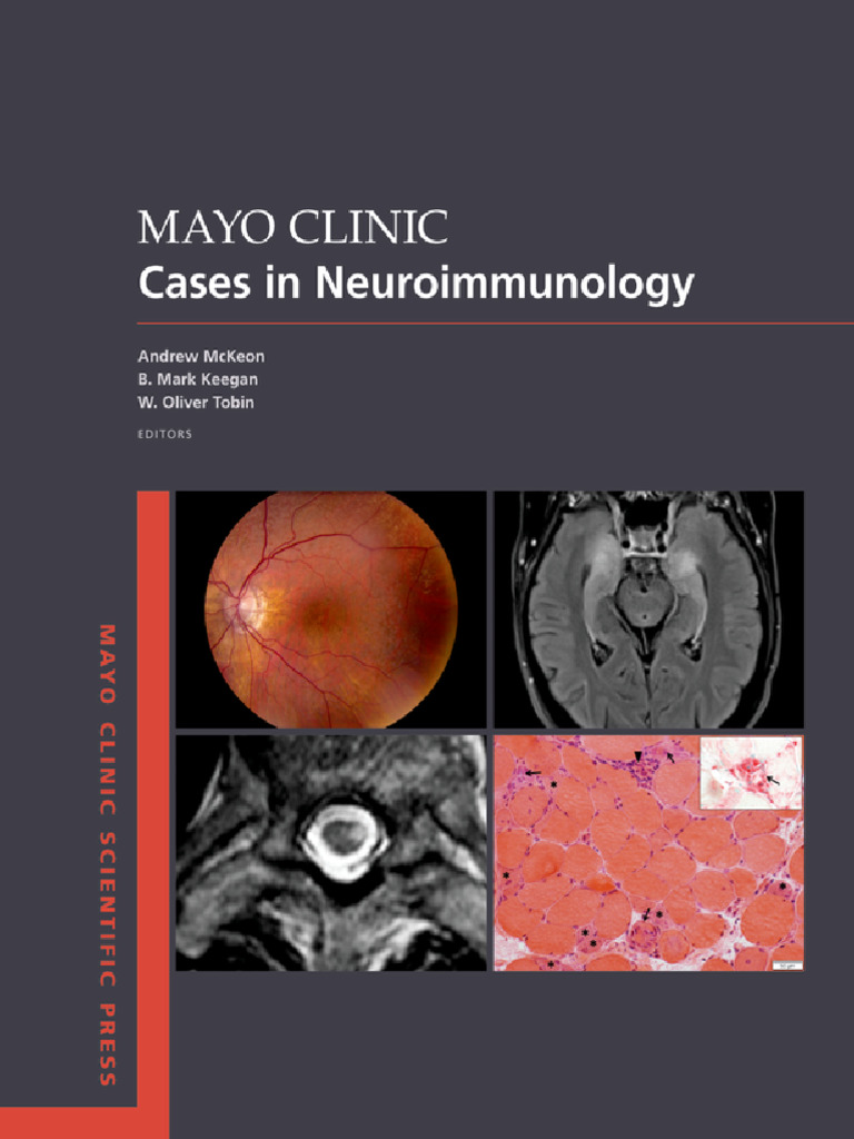 Mayo Clinic Cases in Neuroimmunology (Andrew McKeon, B. Mark Keegan, W ...