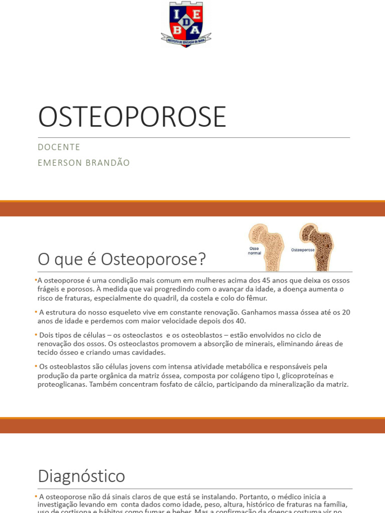 OSTEOPOROSE | PDF | Osteoporose | Osso