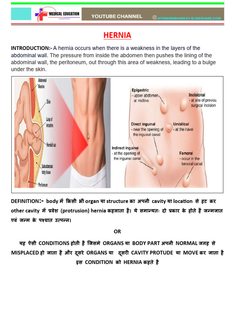 Hernia Medical Surgical Nursing PDF | PDF | Abdomen | Clinical Medicine
