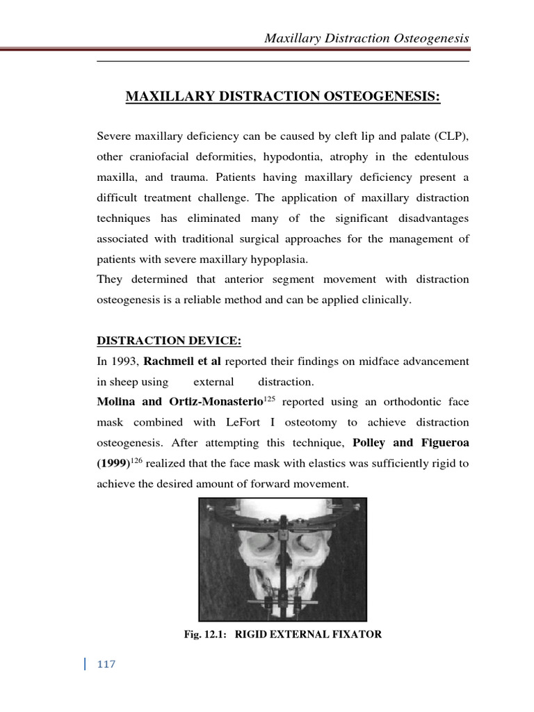 Maxillary Distraction Osteogenesis. | PDF | Orthodontics | Dentistry