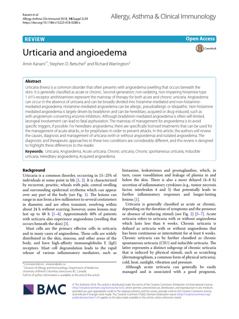 Urticaria and Angioedema | PDF | Medical Specialties | Clinical Medicine