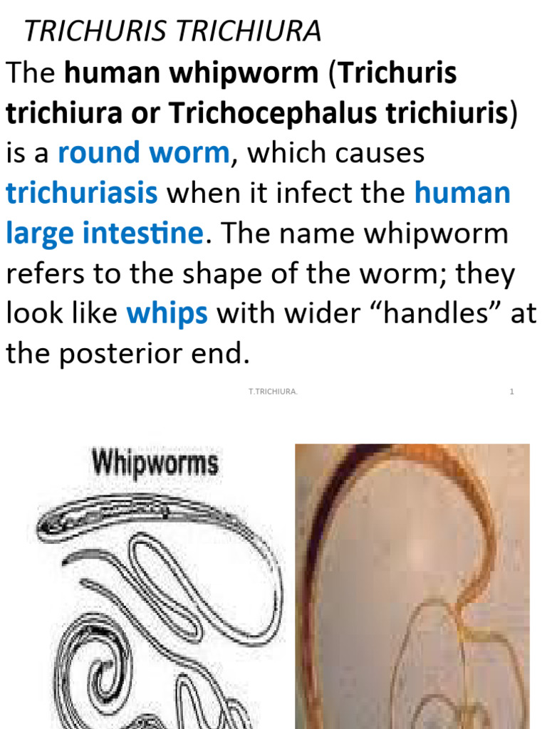 Trichuris Trichiura | PDF | Diseases And Disorders | Microbiology