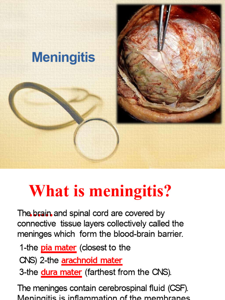 Meningitis | PDF | Meningitis | Immunology