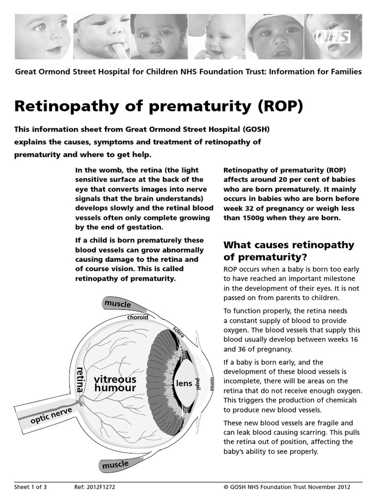 Retinopathy of Prematurity F1272 A4 BW FINAL Nov12 | PDF | Visual ...