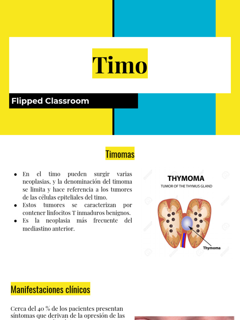 Fisiopatologia Timo | PDF | Timo | Cáncer
