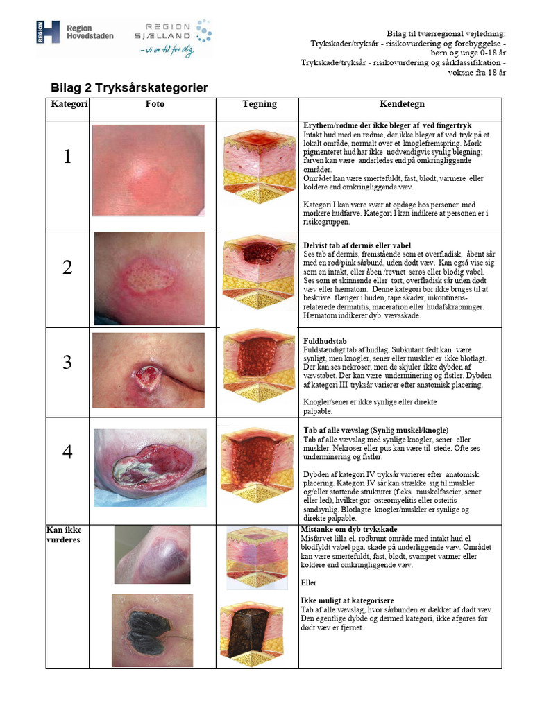 Bilag 2 Tryksårskategorier | PDF