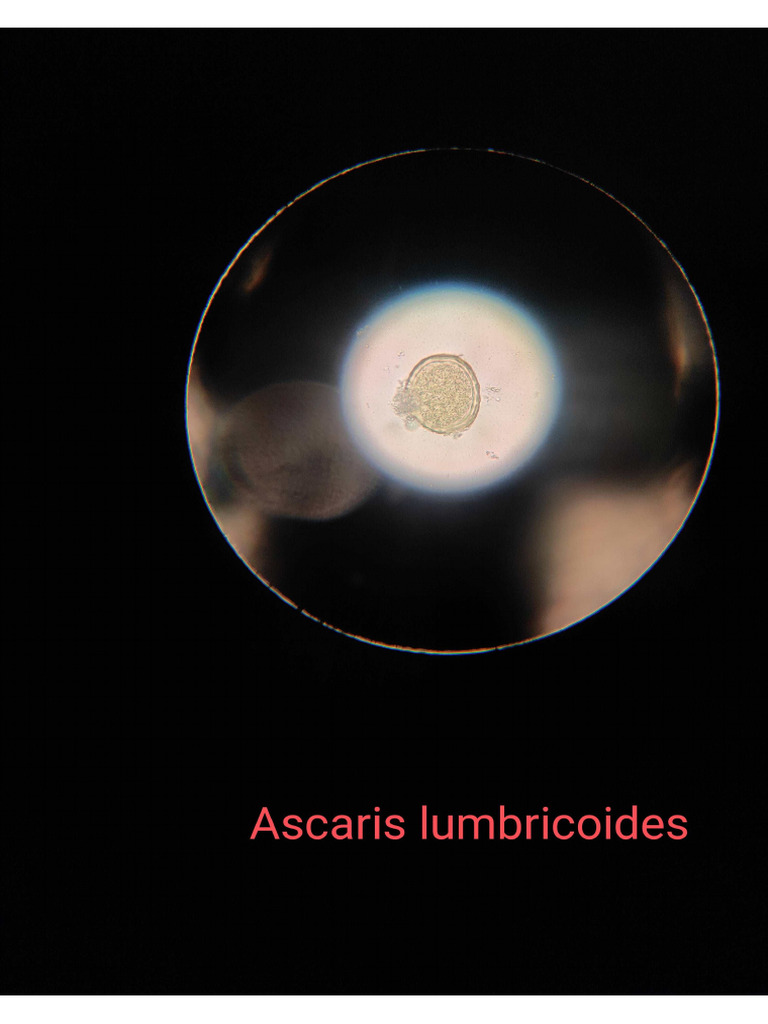 Stool Examination Photos | PDF