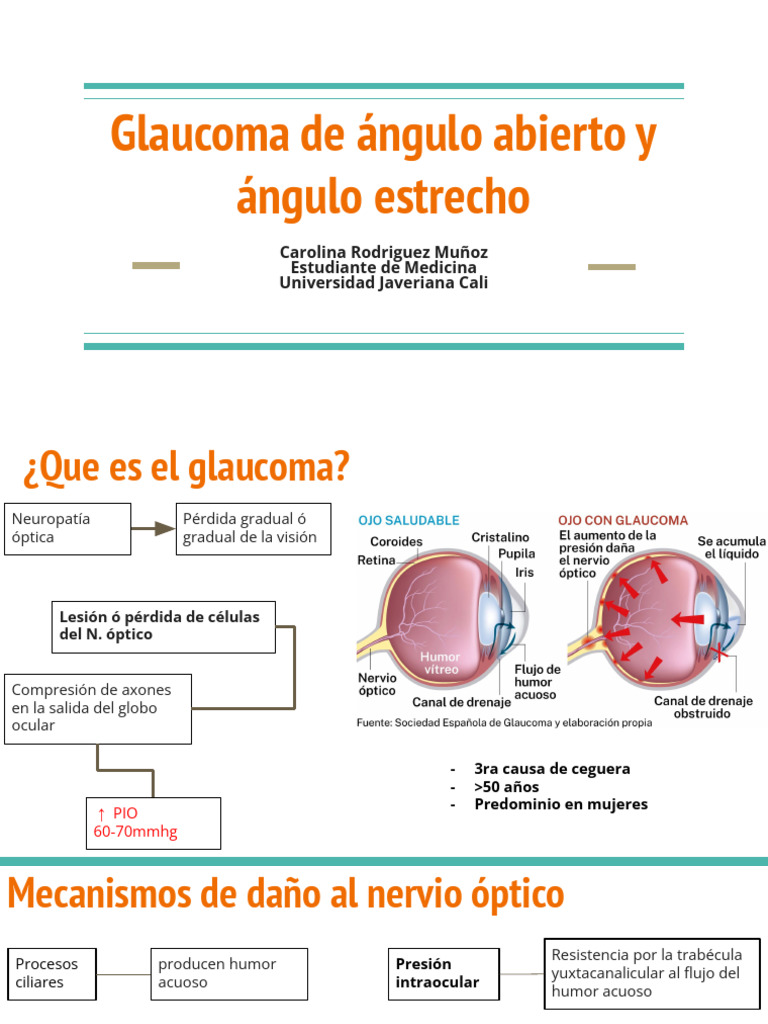 Glaucoma: Ángulo Abierto y Estrecho | PDF | Glaucoma | Ojo humano