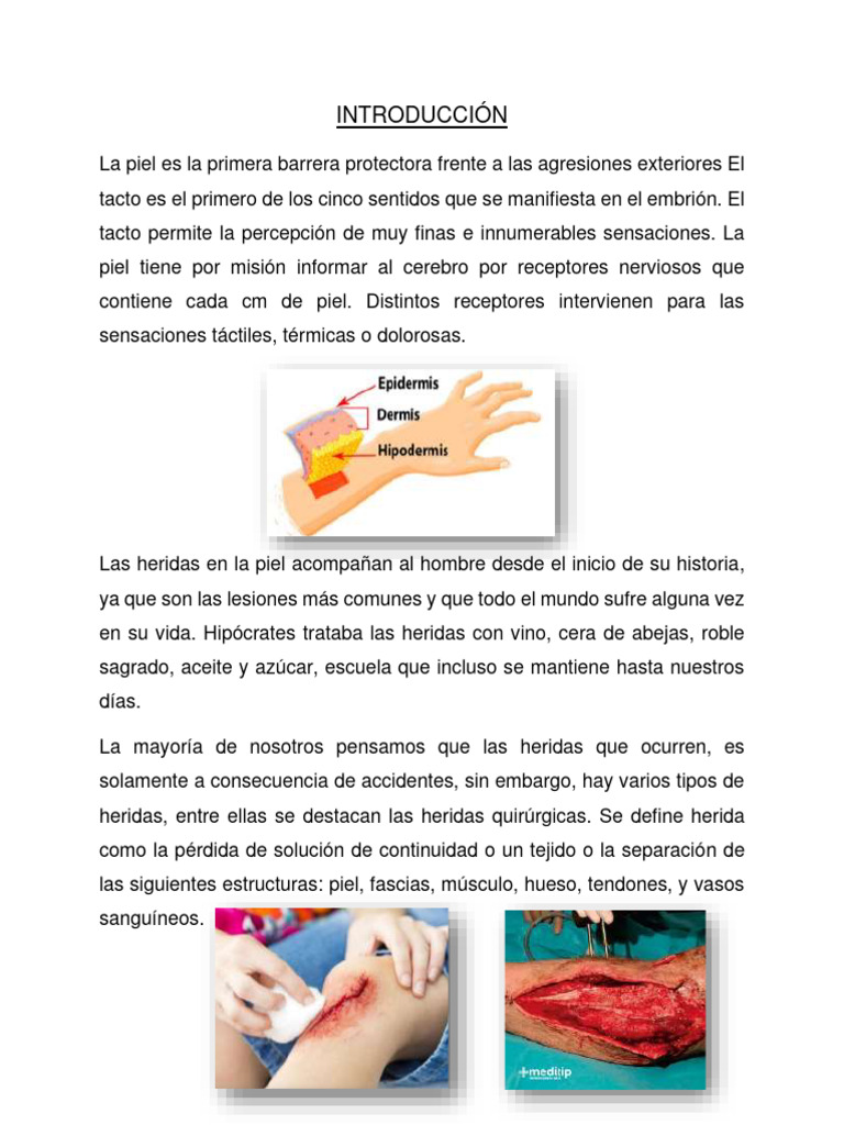Resumen Heridas. | PDF | Herida | Inflamación