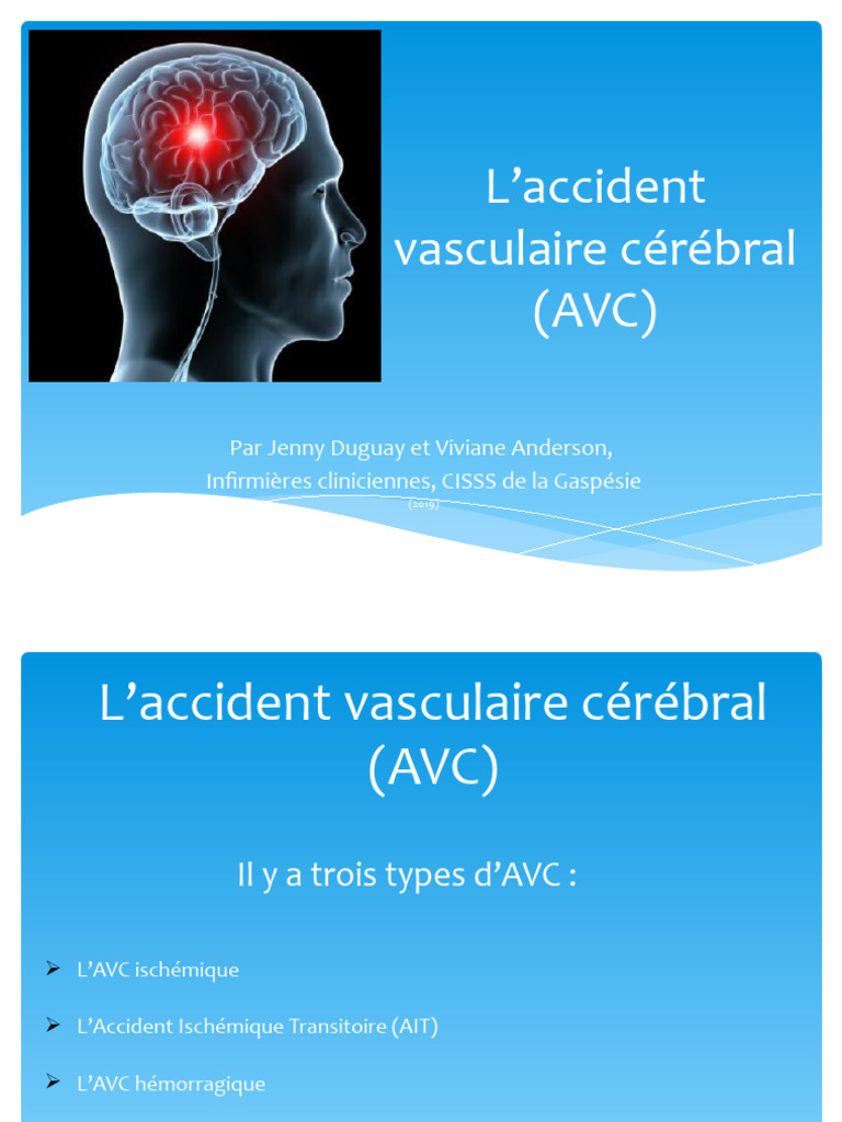 Laccident Vasculaire Cerebral AVC | PDF | Accident vasculaire cérébral | Système cardio-vasculaire