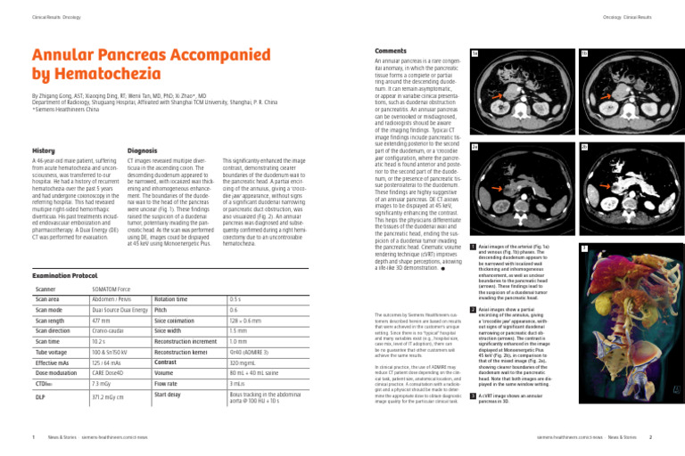 Siemens Healthineers Ct News Annular Pancreas Case Report 06866741