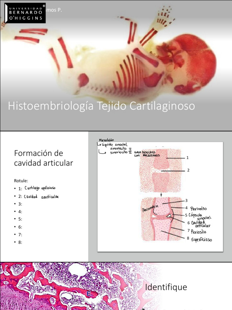 Condroplasma y Matriz Territorial en Cartílago | PDF | Cartílago | La ...