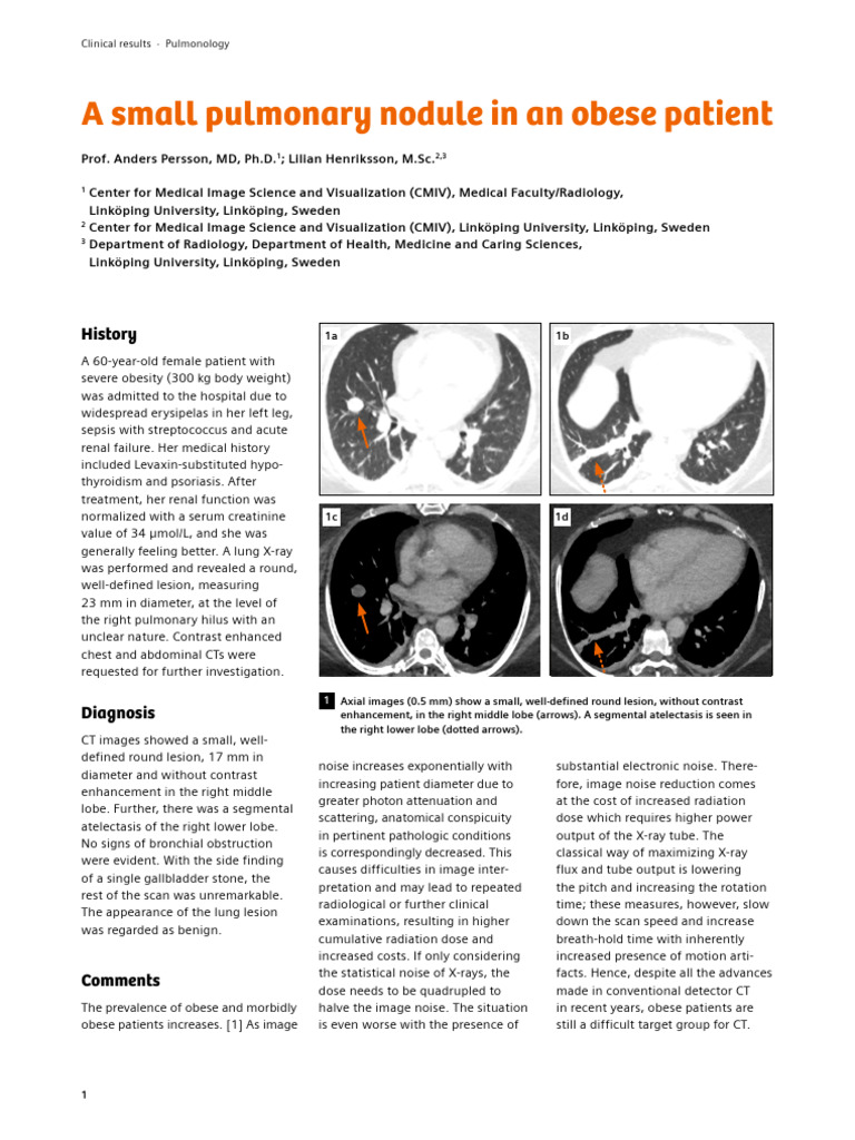 Siemens-Healthineers CT News-Stories Obese Alpha Linkoeping | PDF | Ct ...