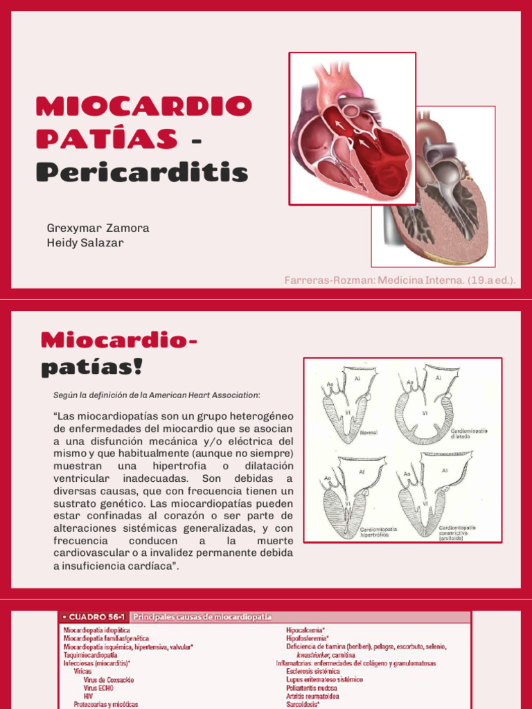 Miocardiopatías + Pericarditis-1 | PDF | Corazón | Causas de la muerte