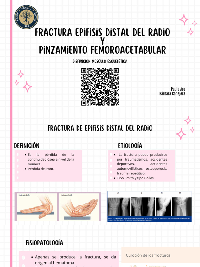 Fractura Epifisis Distal Del Radio y Pinzamiento Femoroacetabular | PDF ...