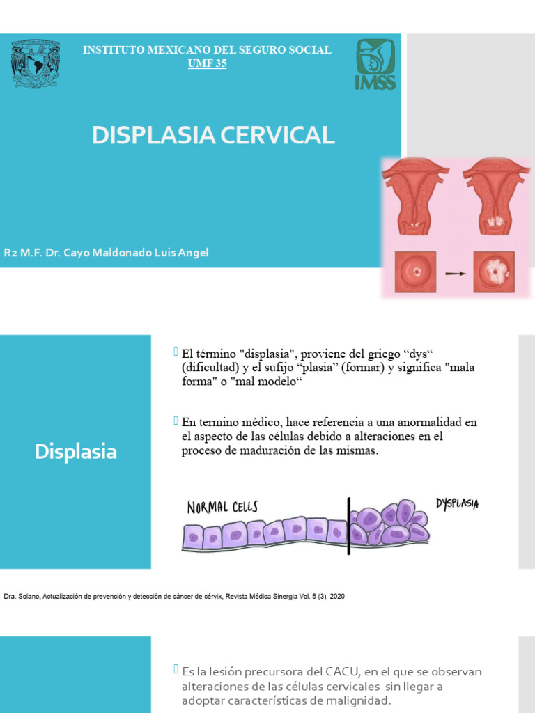 Displasia Cervical | PDF | Cáncer de cuello uterino | Enfermedades y trastornos