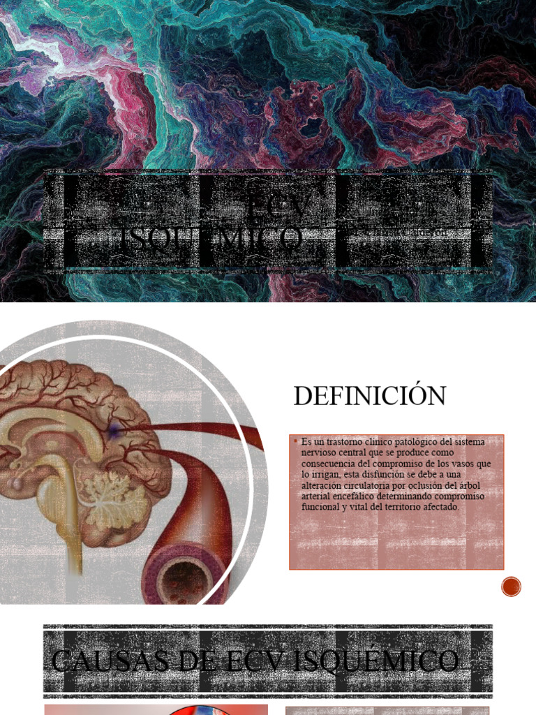 Ecv Isquemico | PDF | Carrera | Aterosclerosis