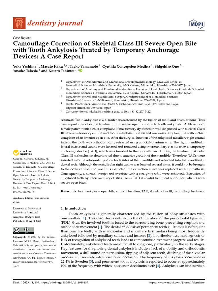 Camouflage Correction of Skeletal Class III Severe | PDF | Orthodontics ...