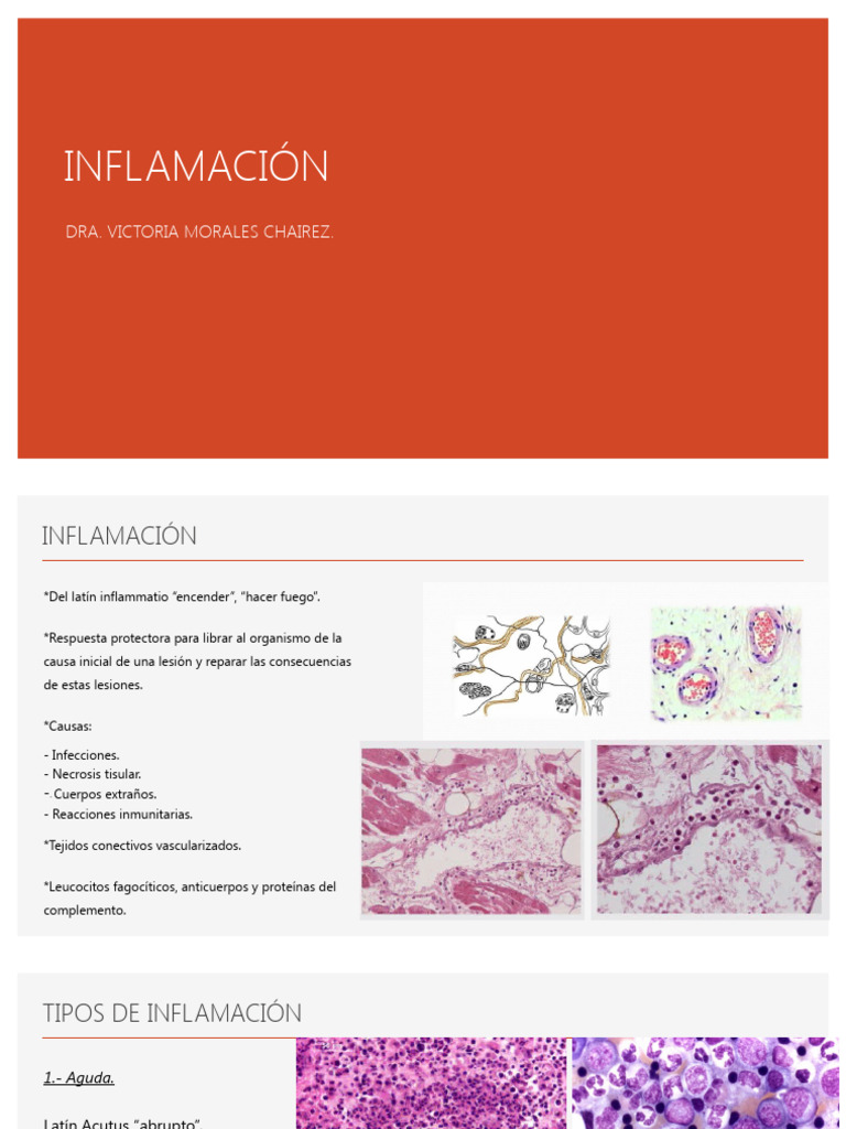 Inflamacion Aguda y Cronica | PDF | Inflamación | Cicatrización de la ...