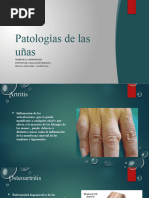 Guía sobre Cromoniquia y Alteraciones Ungueales | PDF | Clavo (anatomía ...