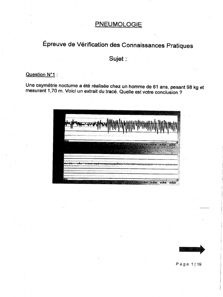 38 Evcp | PDF