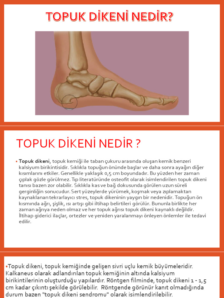 Topuk Dikeni | PDF