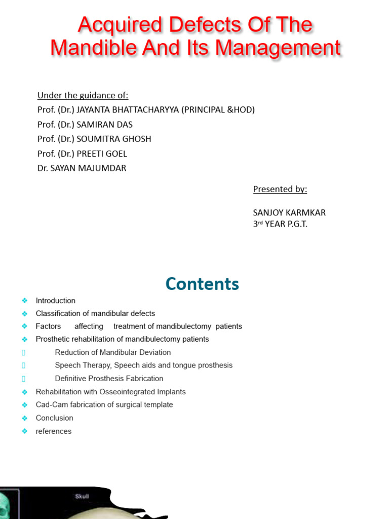 Mandibular Defects: Classification & Management | PDF | Dental Implant ...