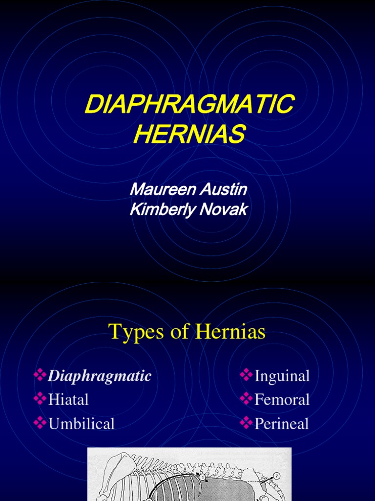 Diaphragmatic Hernias: Maureen Austin Kimberly Novak | PDF | Thorax ...