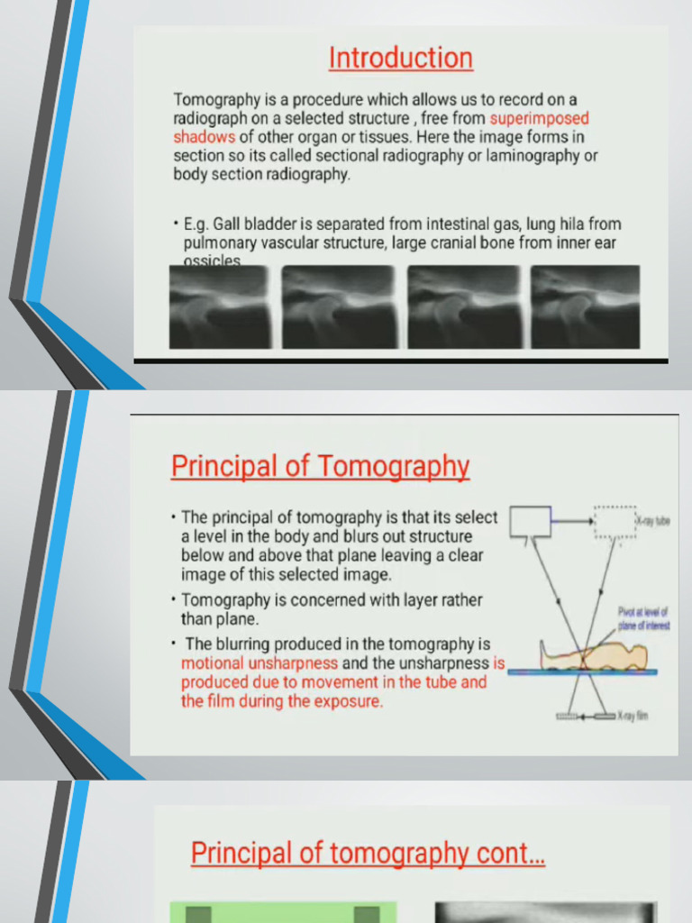 Tomography | PDF